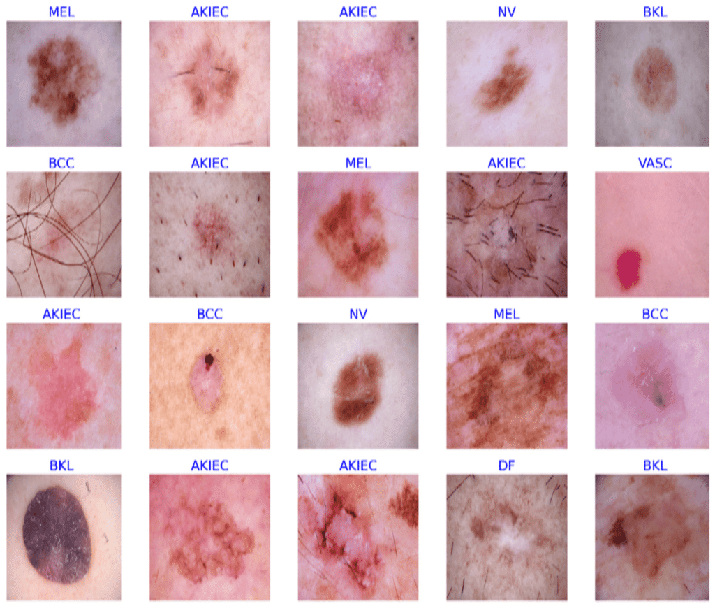 SERIOUS Diseases Diagnosed Via Skin Signals!